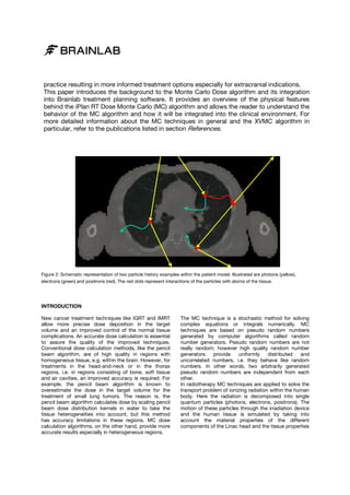 Monte Carlo Dose Algorithm Clinical White Paper | PDF