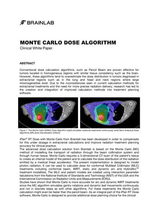 Monte Carlo Dose Algorithm Clinical White Paper | PDF