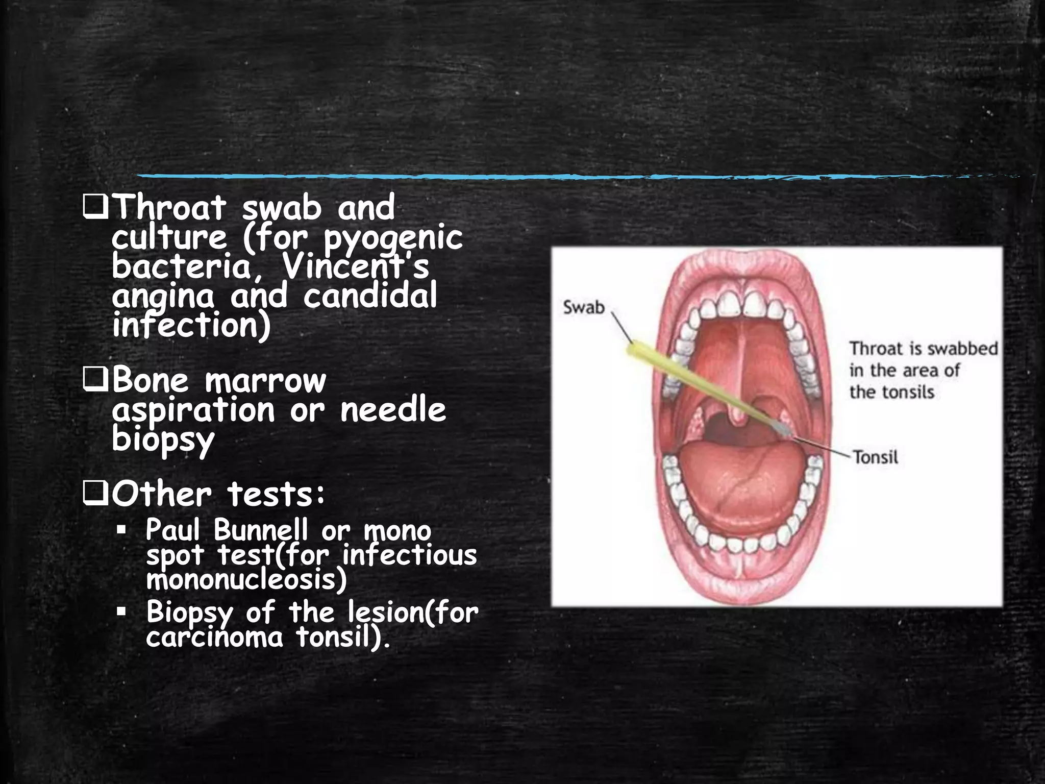 White patch on the tonsil – differential diagnosis | PPTX