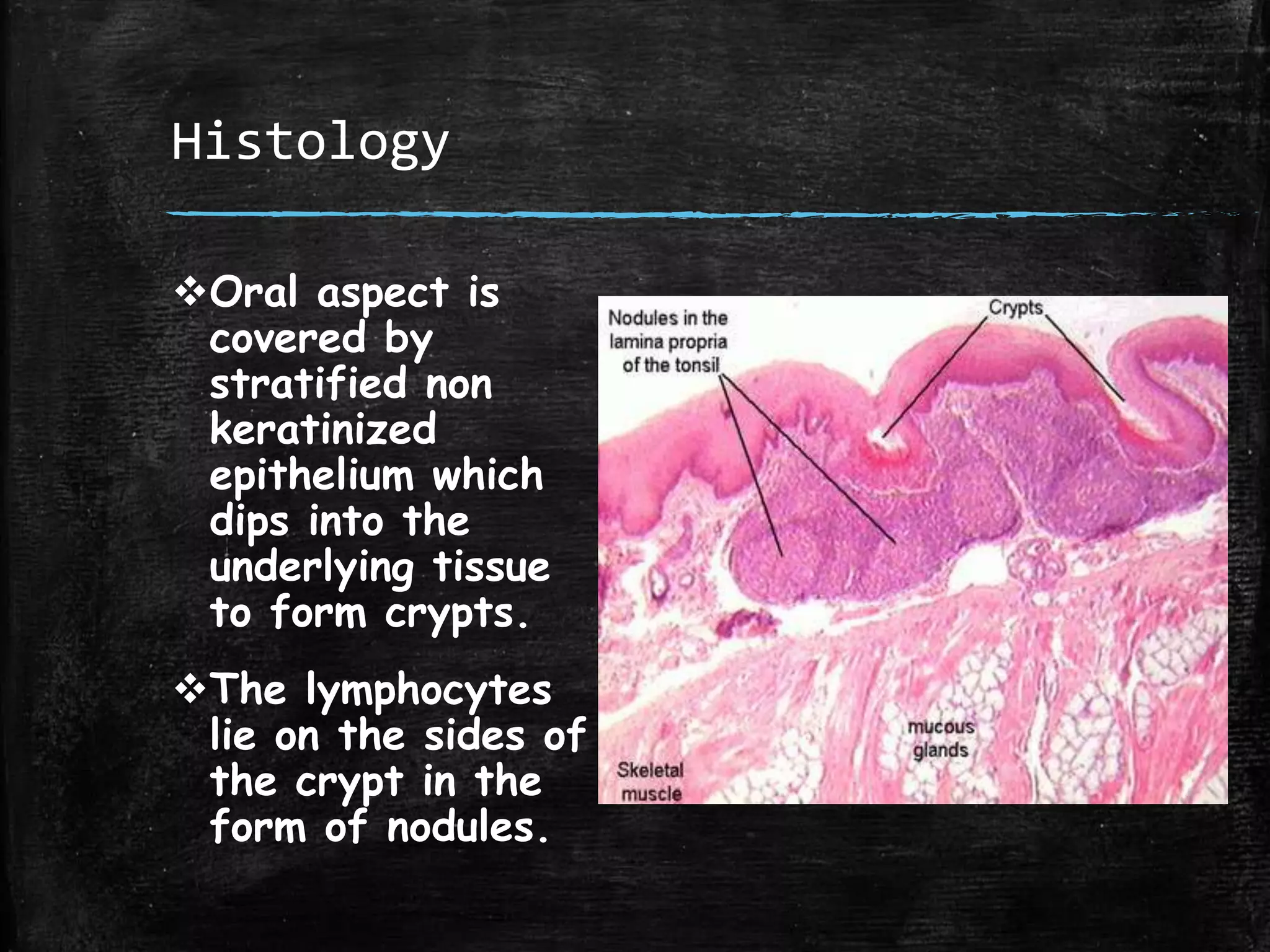 White patch on the tonsil – differential diagnosis | PPTX