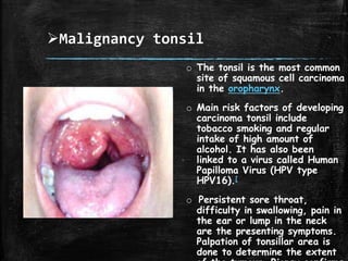 White patch on the tonsil – differential diagnosis | PPTX