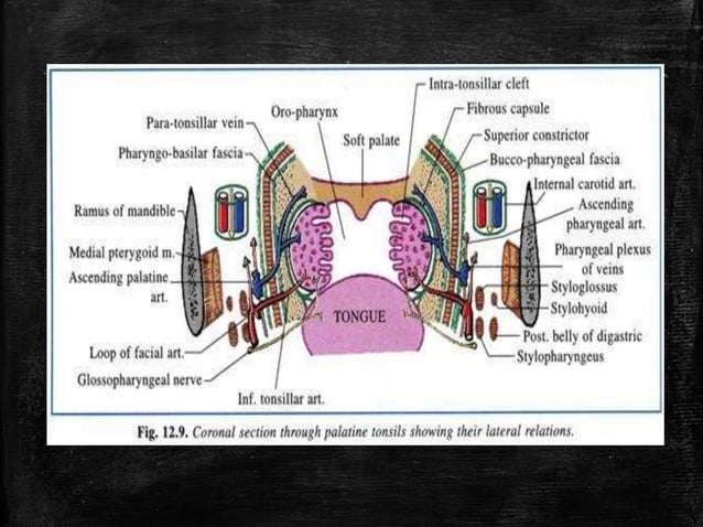 White patch on the tonsil – differential diagnosis | PPTX | Ear, Nose ...