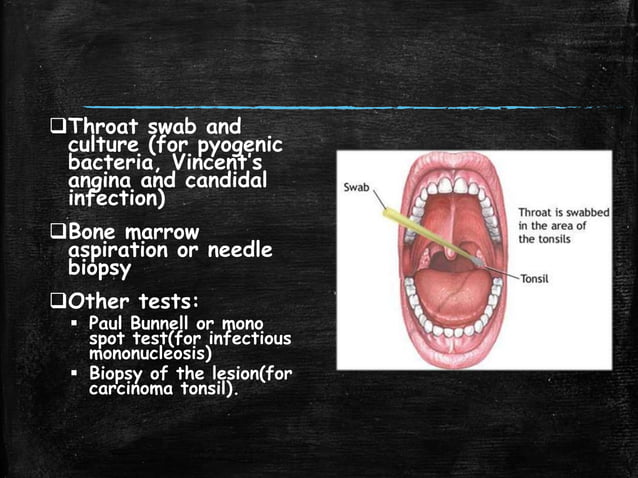 White Patch On The Tonsil Differential Diagnosis