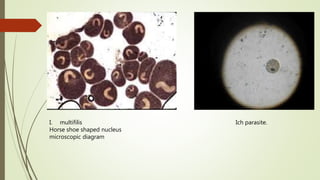 White spot disease in fish | PPTX