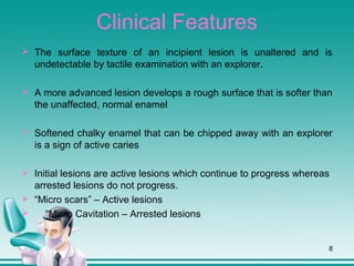 White spot lesion | PPT