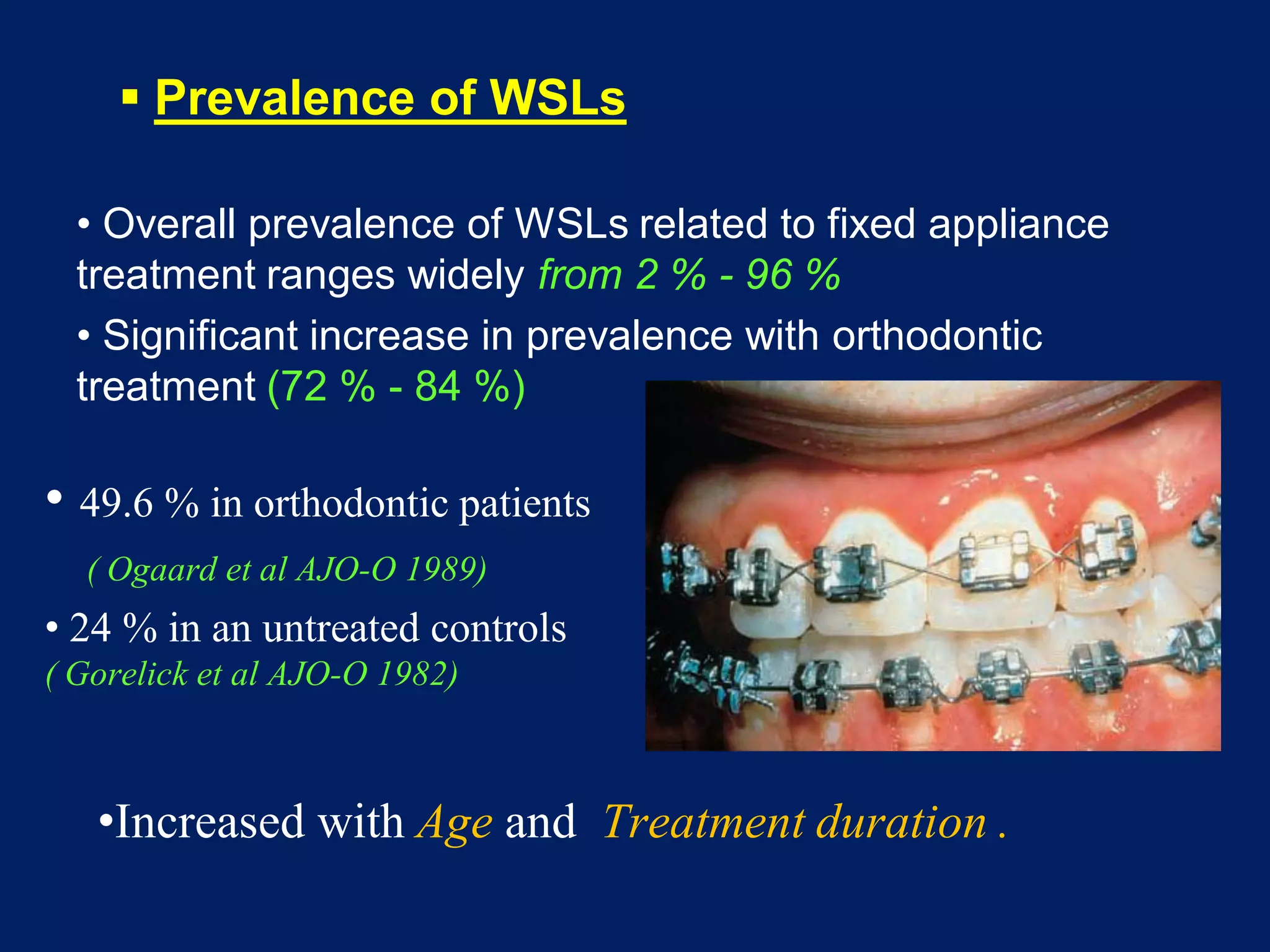 White spot lesions | PDF