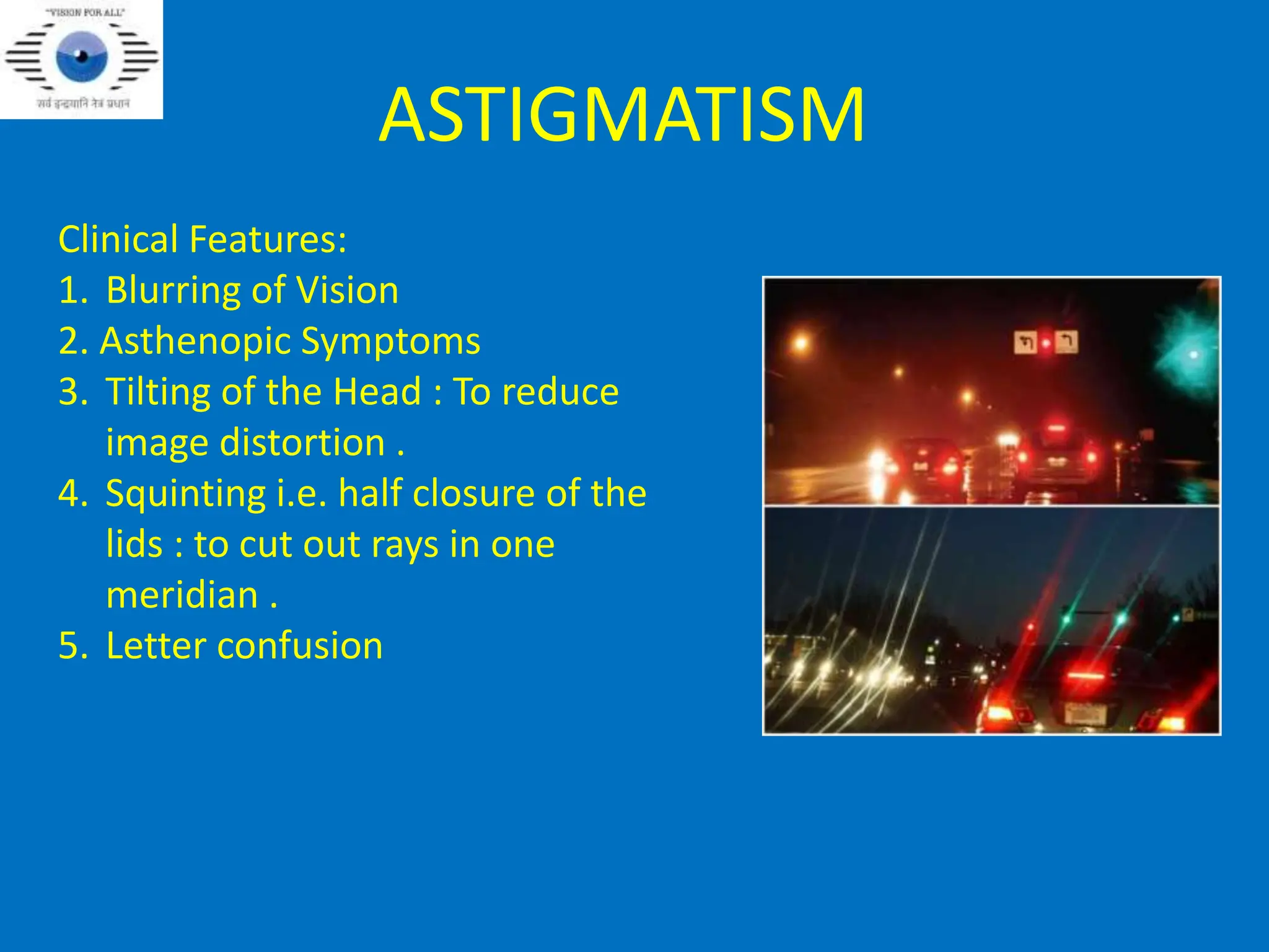 ASTIGAMATISM presentation dhir hospital.pptx