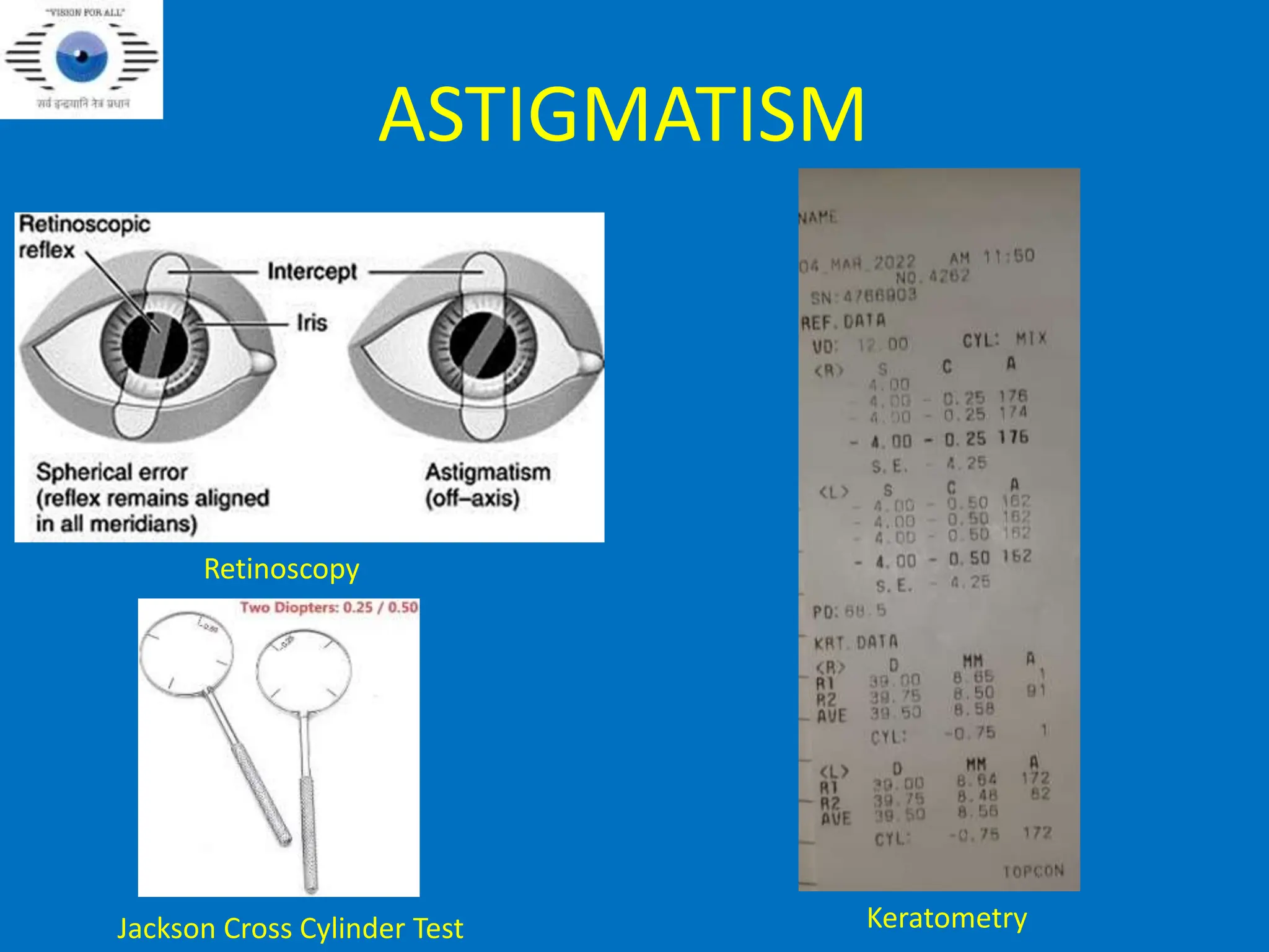 ASTIGAMATISM presentation dhir hospital.pptx