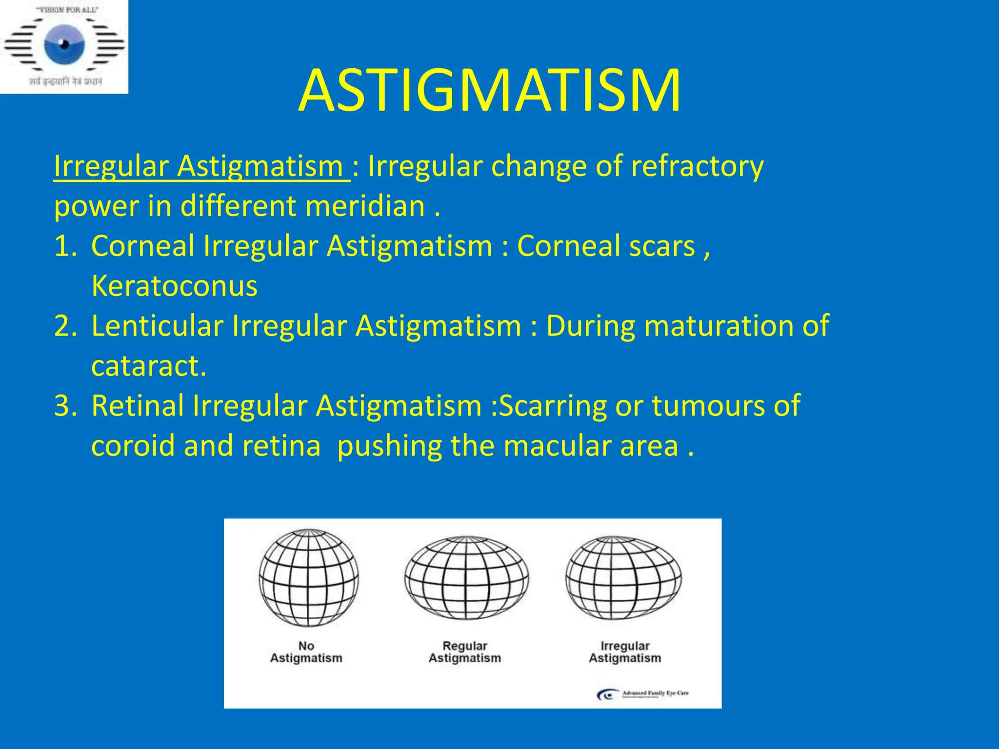 ASTIGAMATISM presentation dhir hospital.pptx