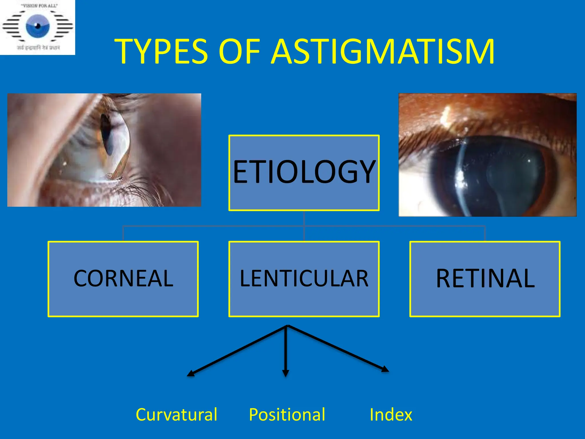 ASTIGAMATISM presentation dhir hospital.pptx