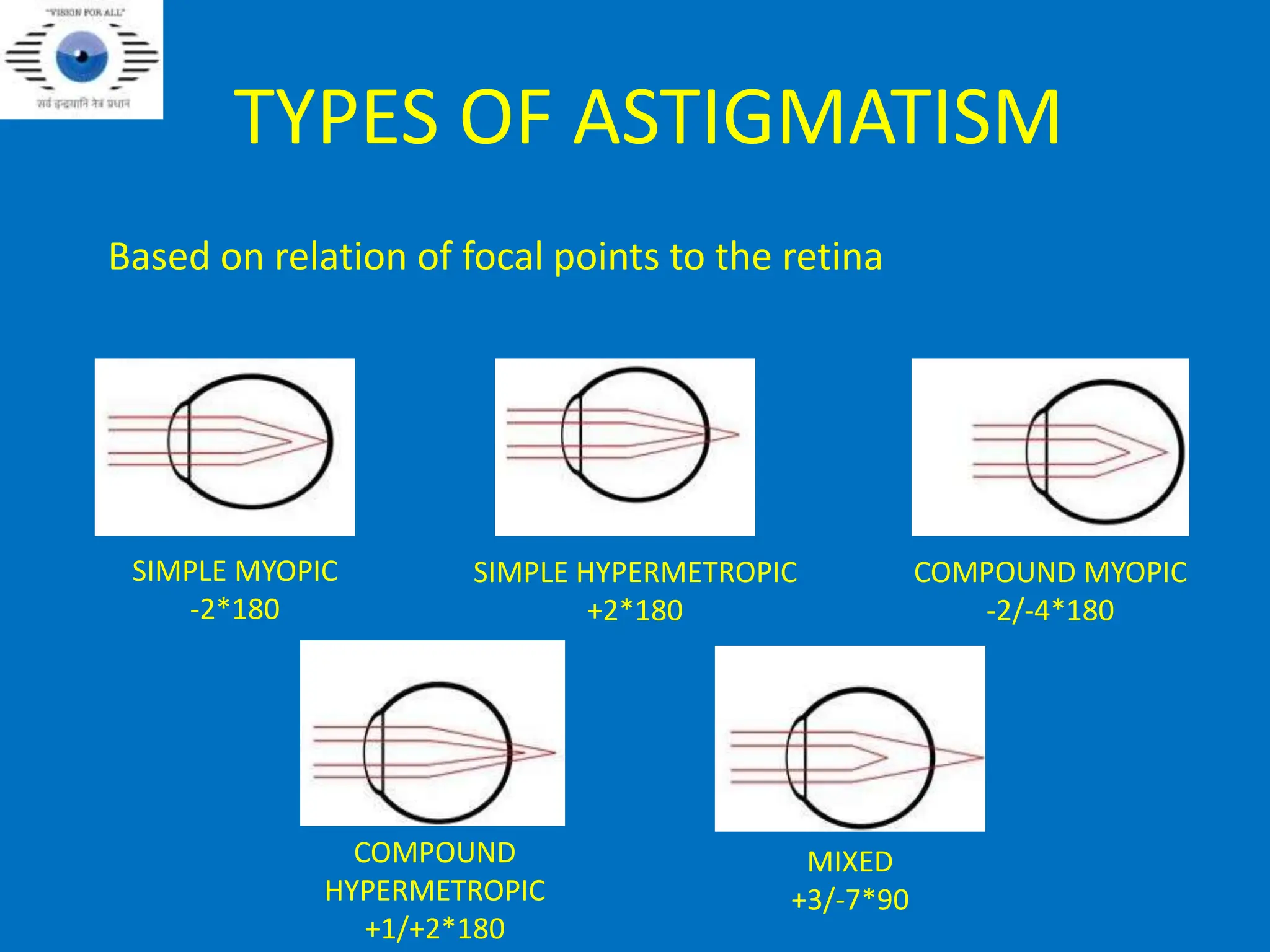 ASTIGAMATISM presentation dhir hospital.pptx