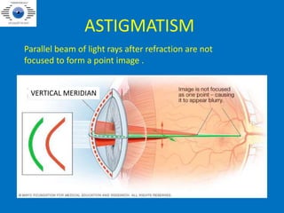 ASTIGAMATISM presentation dhir hospital.pptx | Eye and Vision ...
