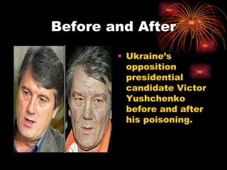 Viktor Yushchenko Before And After Poisoning