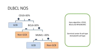 WHO 2016 lymphoma classification | PPTX
