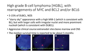 WHO 2016 lymphoma classification | PPTX