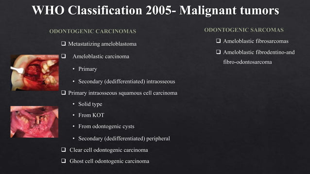 Odontogenic and Non-odontogenic Tumors - Update from the 4th Edition of ...