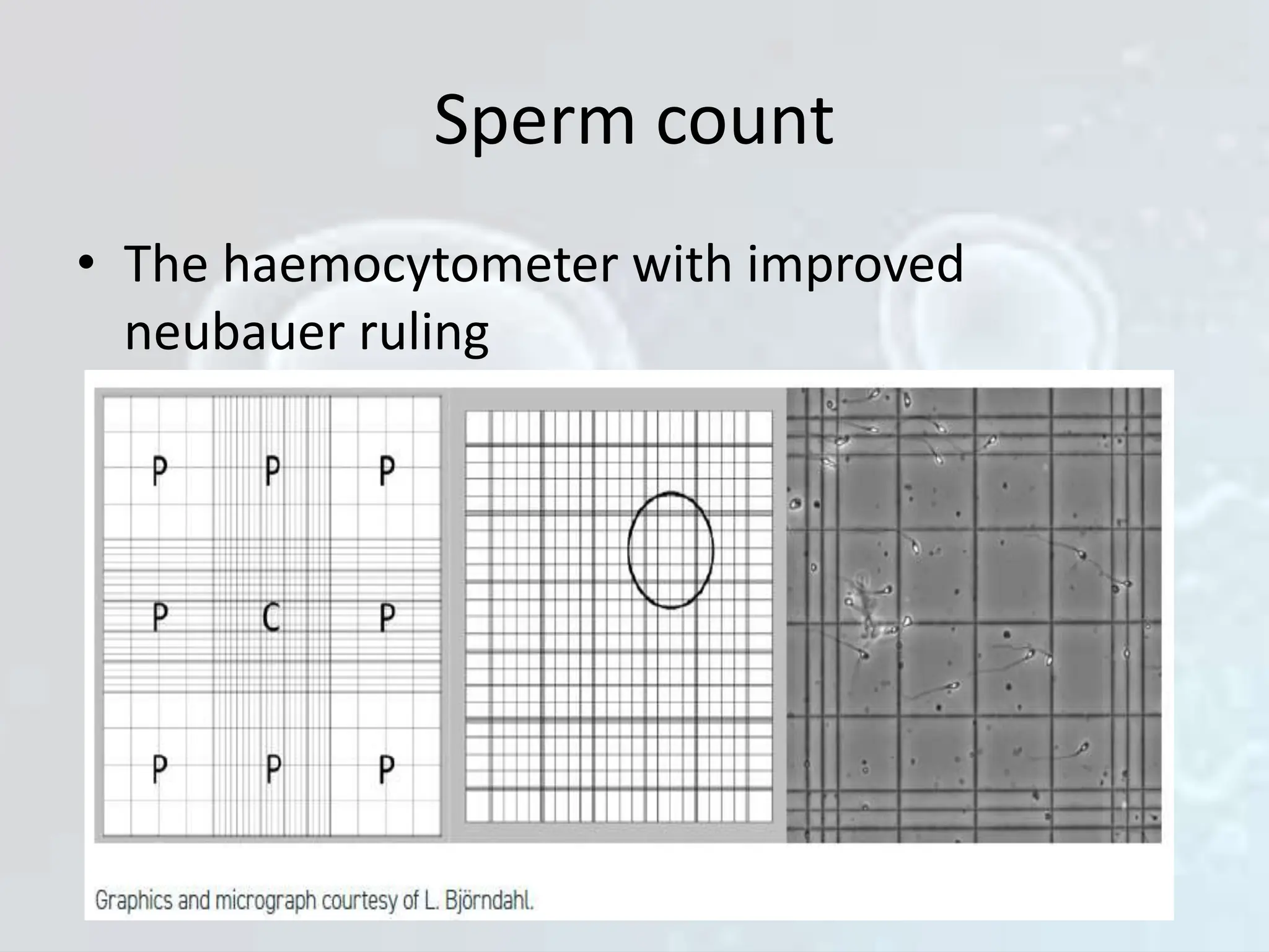 WHO 6TH EDITION UPDATE FOR SEMEN ANALYSIS | PPTX