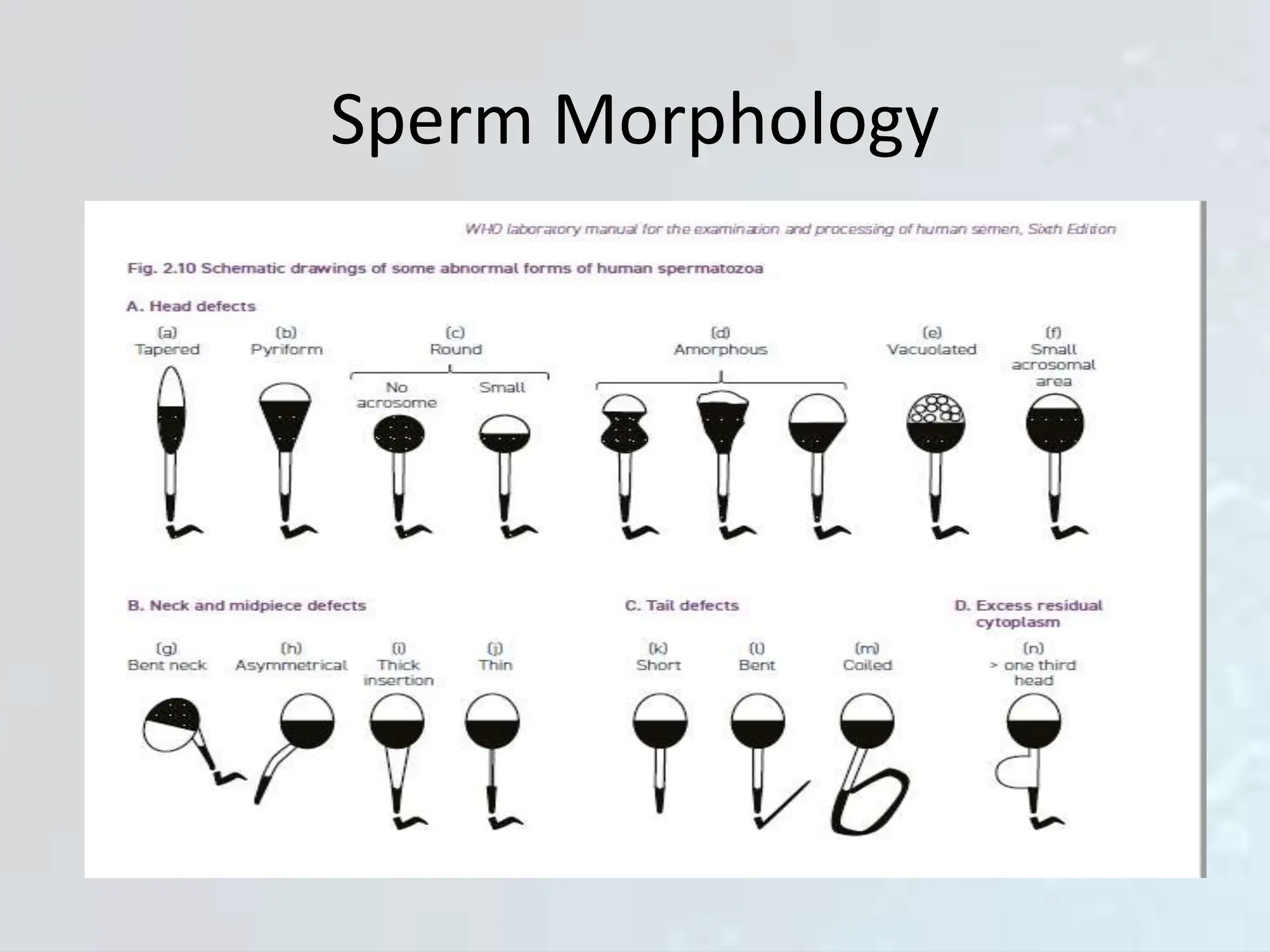 WHO 6TH EDITION UPDATE FOR SEMEN ANALYSIS | PPTX