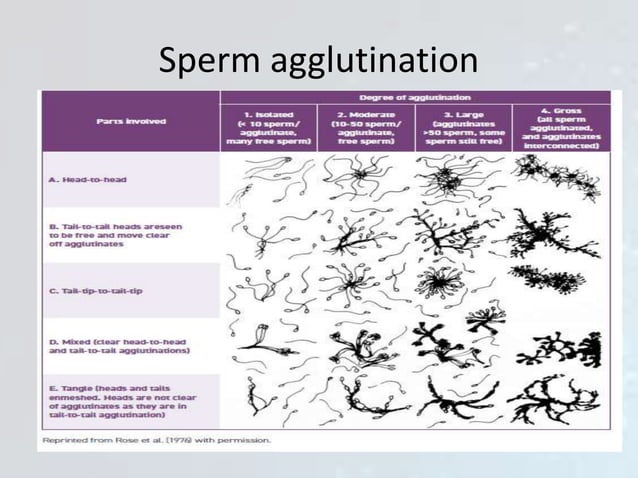 WHO 6TH EDITION UPDATE FOR SEMEN ANALYSIS | PPTX | Infertility ...