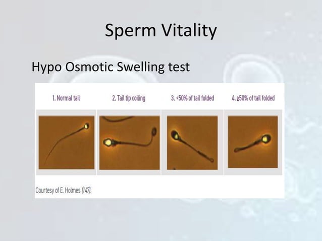 WHO 6TH EDITION UPDATE FOR SEMEN ANALYSIS | PPTX | Infertility ...