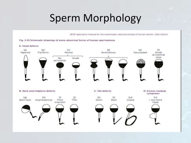 WHO 6TH EDITION UPDATE FOR SEMEN ANALYSIS | PPTX | Infertility | Reproductive Health