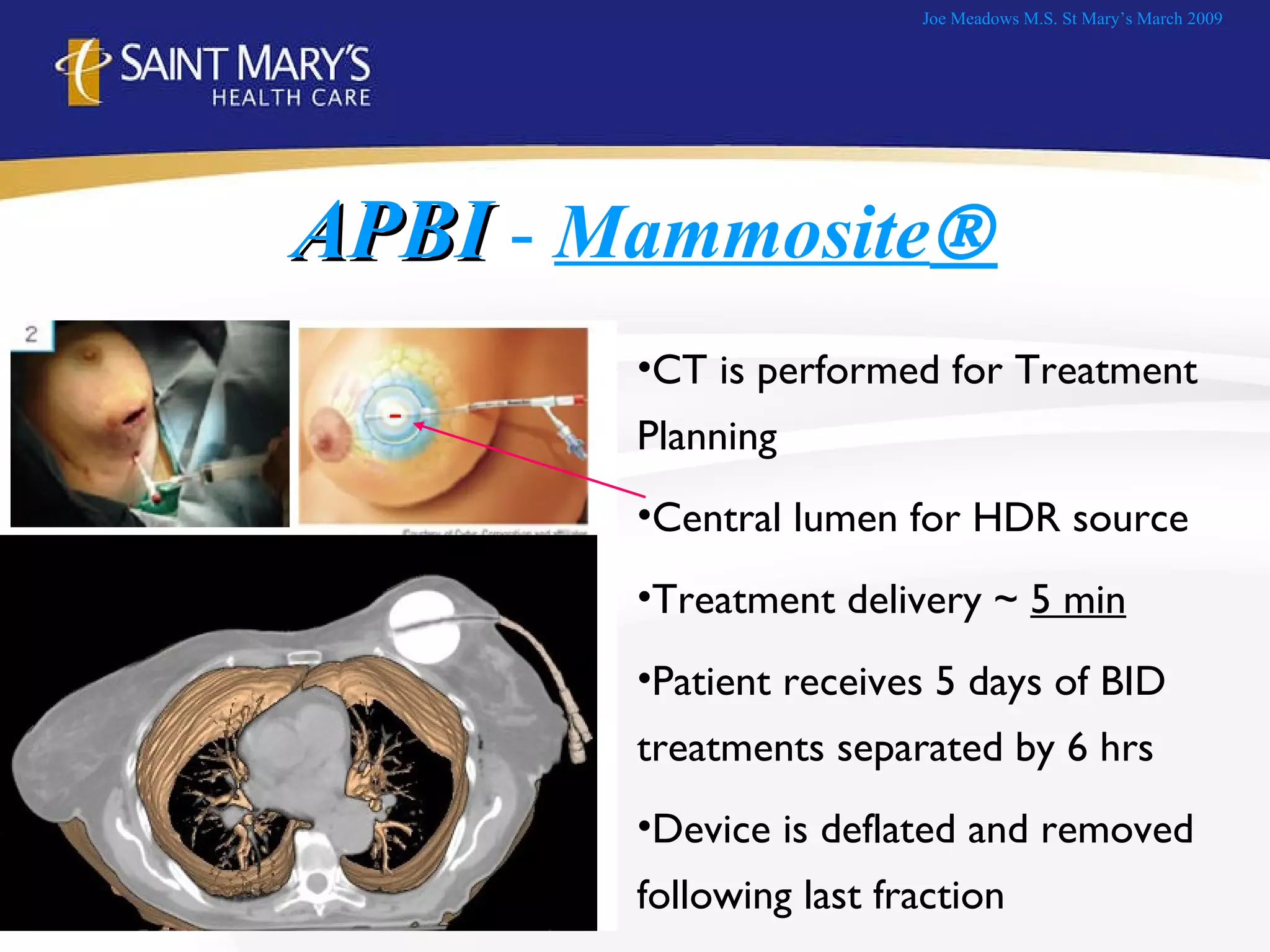 Who Benefits From Apbi March2009 | PPT