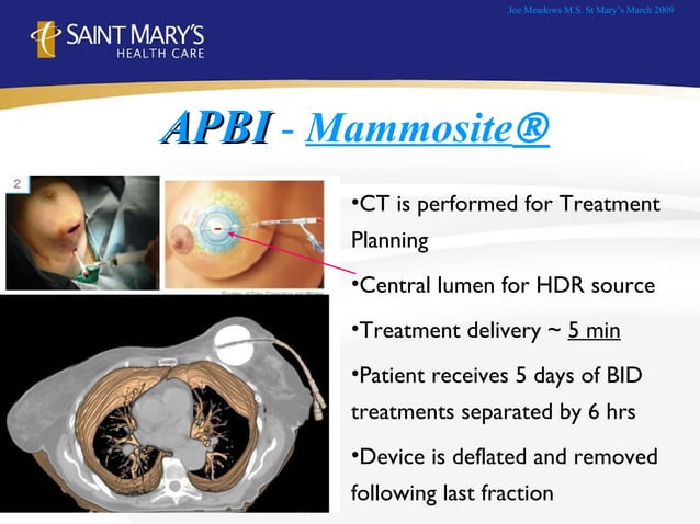 Who Benefits From Apbi March2009 | PPT