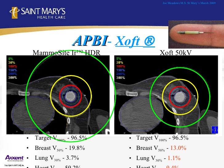 Who Benefits From Apbi March2009