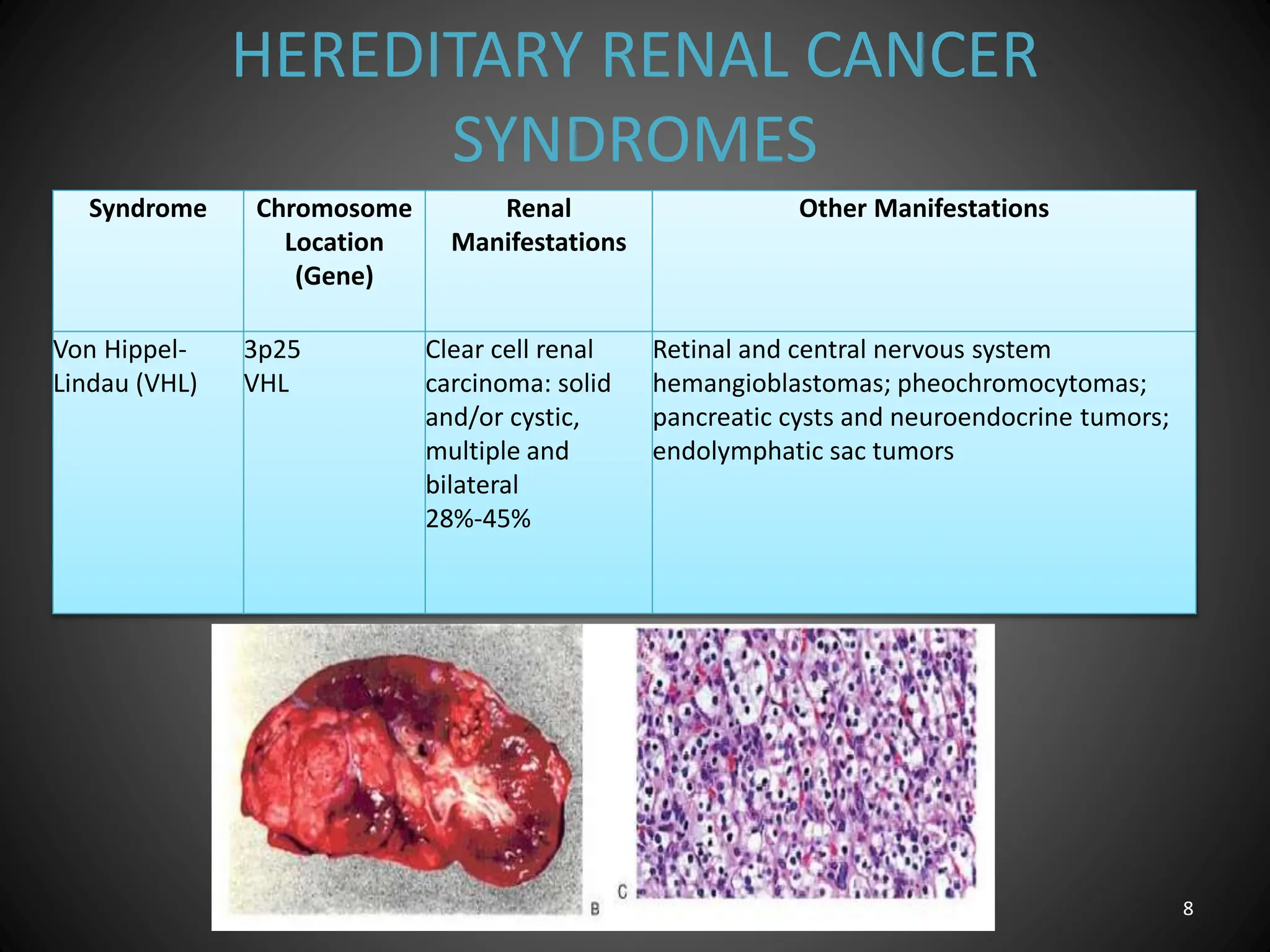 WHO CLASSIFICATION 2016 RENAL CELL CARCINOMA.pptx