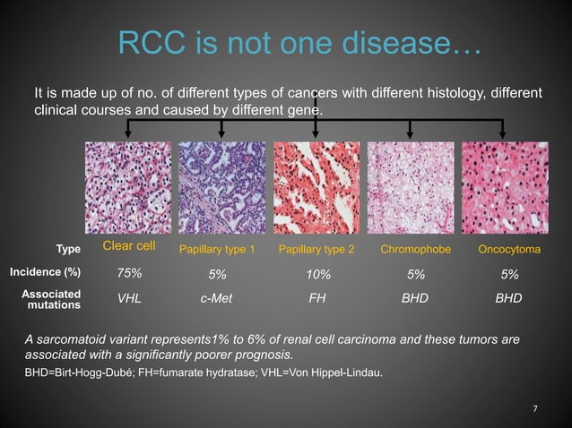 WHO CLASSIFICATION 2016 RENAL CELL CARCINOMA.pptx