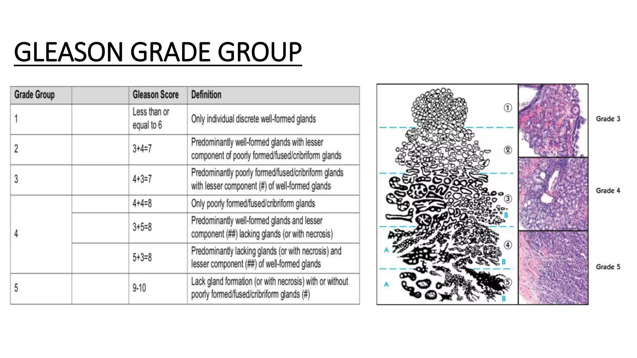 WHO Classification of Tumors fifth edition.pptx