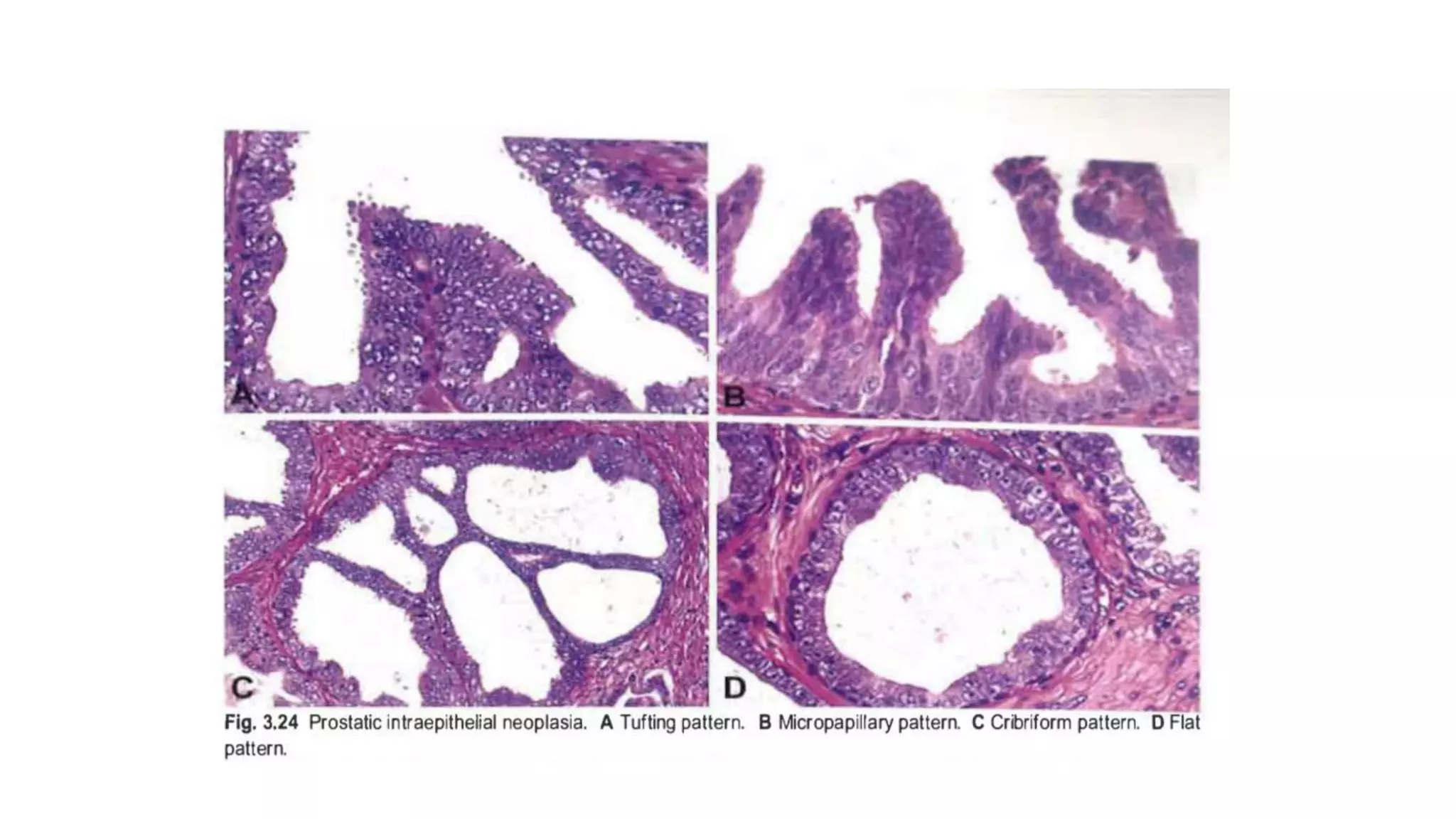 WHO Classification of Tumors fifth edition.pptx