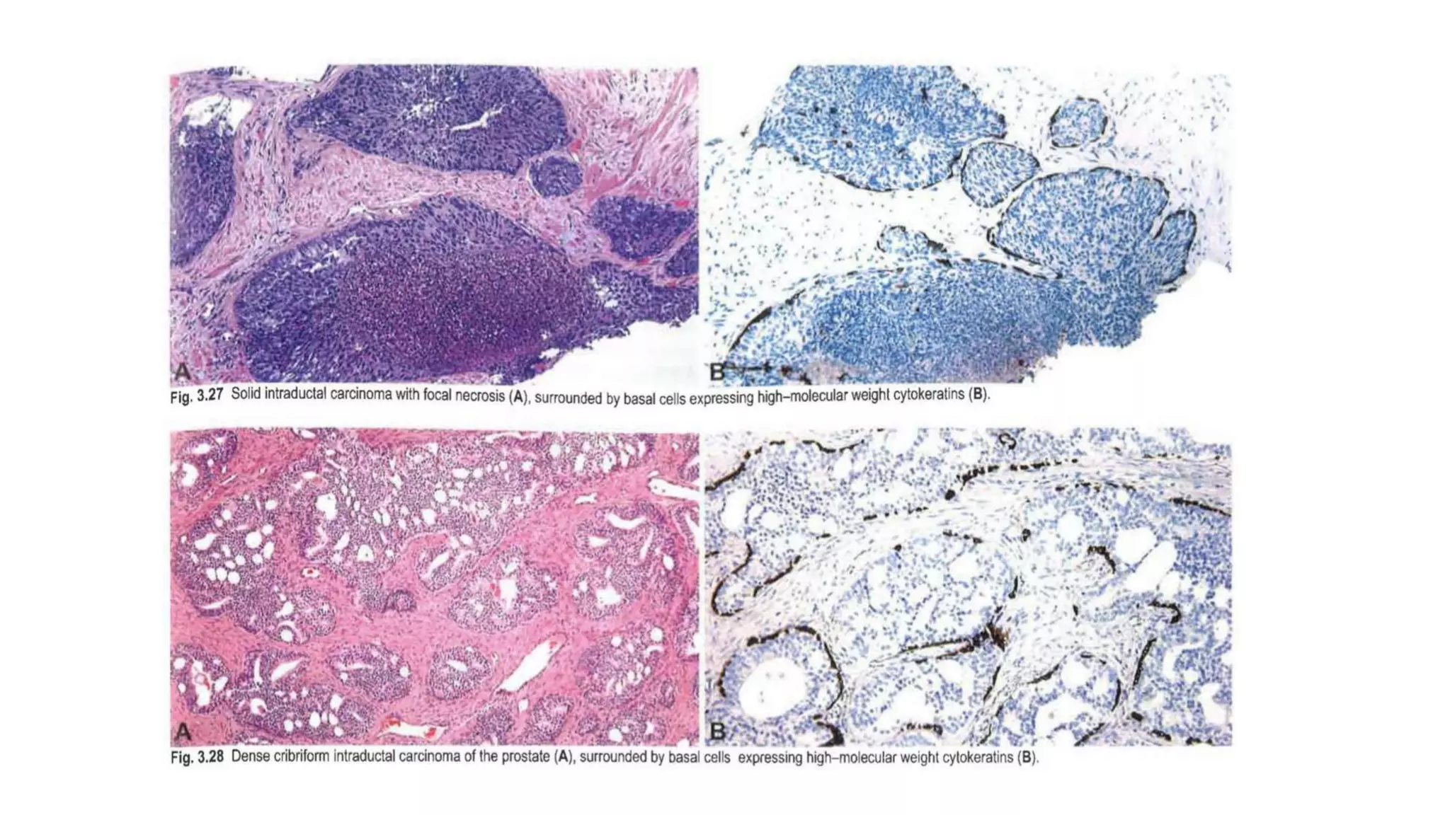 WHO Classification of Tumors fifth edition.pptx