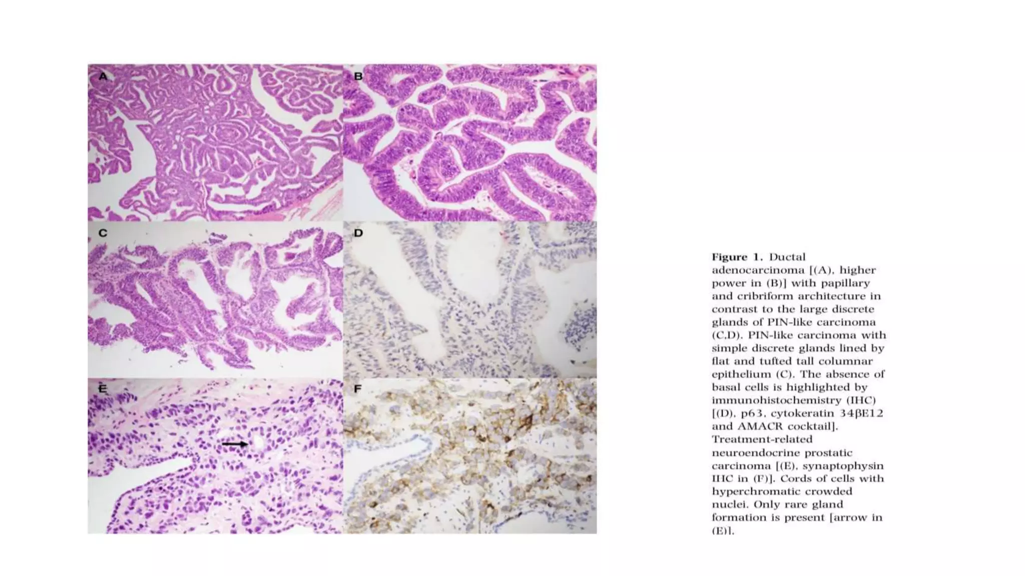 WHO Classification of Tumors fifth edition.pptx