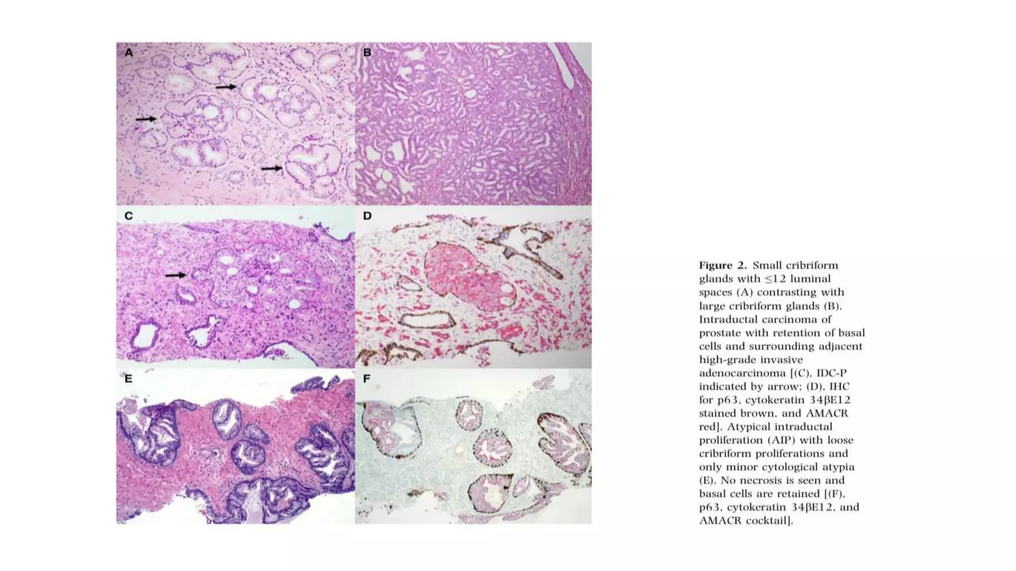 WHO Classification of Tumors fifth edition.pptx