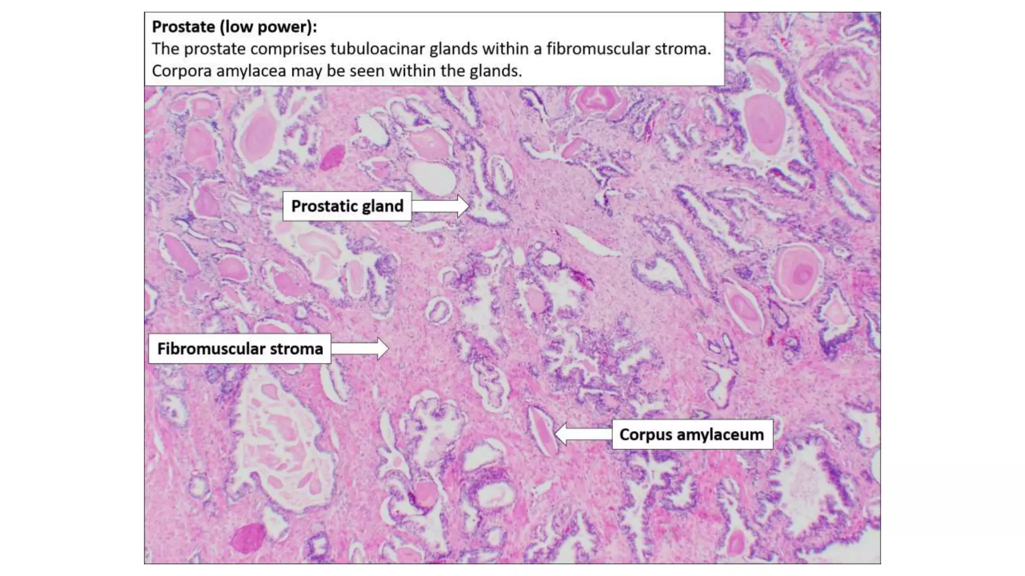 WHO Classification of Tumors fifth edition.pptx
