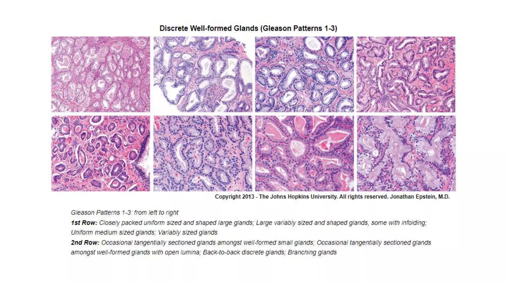 WHO Classification of Tumors fifth edition.pptx