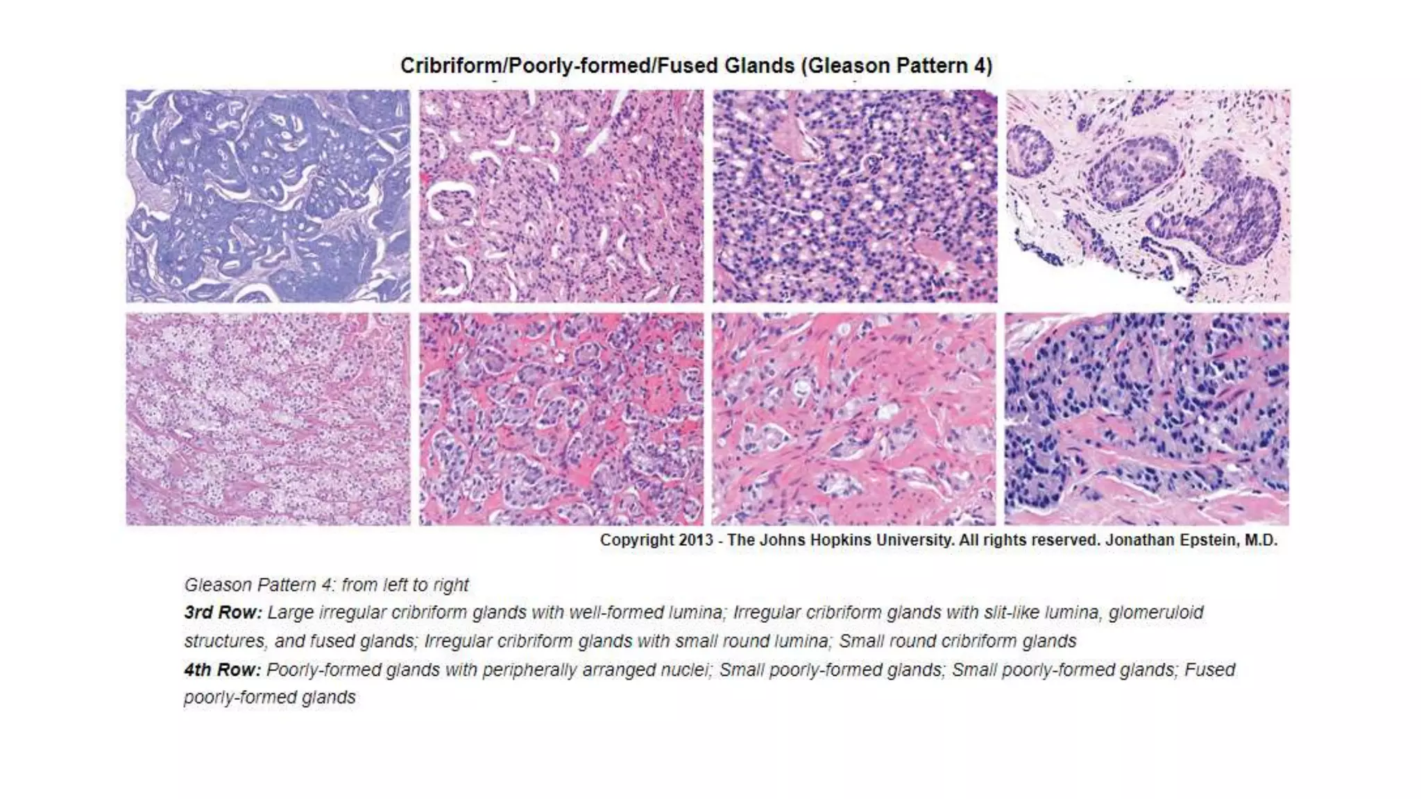 WHO Classification of Tumors fifth edition.pptx