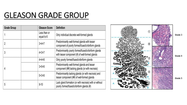 WHO Classification of Tumors fifth edition.pptx | Endocrine and ...