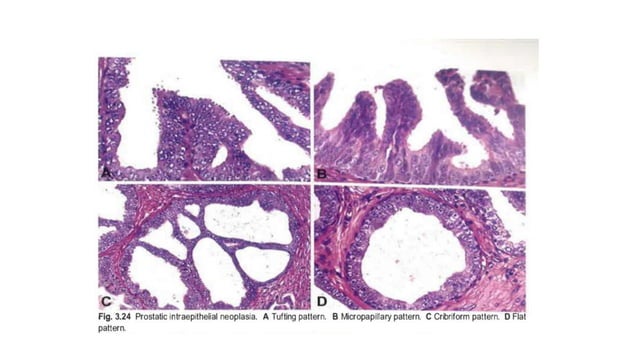WHO Classification of Tumors fifth edition.pptx | Endocrine and ...