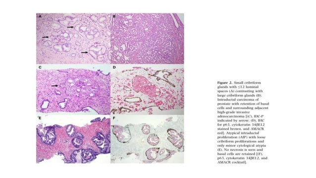 WHO Classification of Tumors fifth edition.pptx | Endocrine and ...