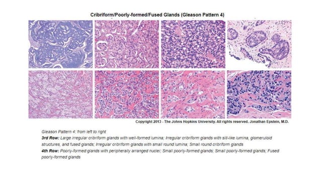WHO Classification of Tumors fifth edition.pptx | Endocrine and ...