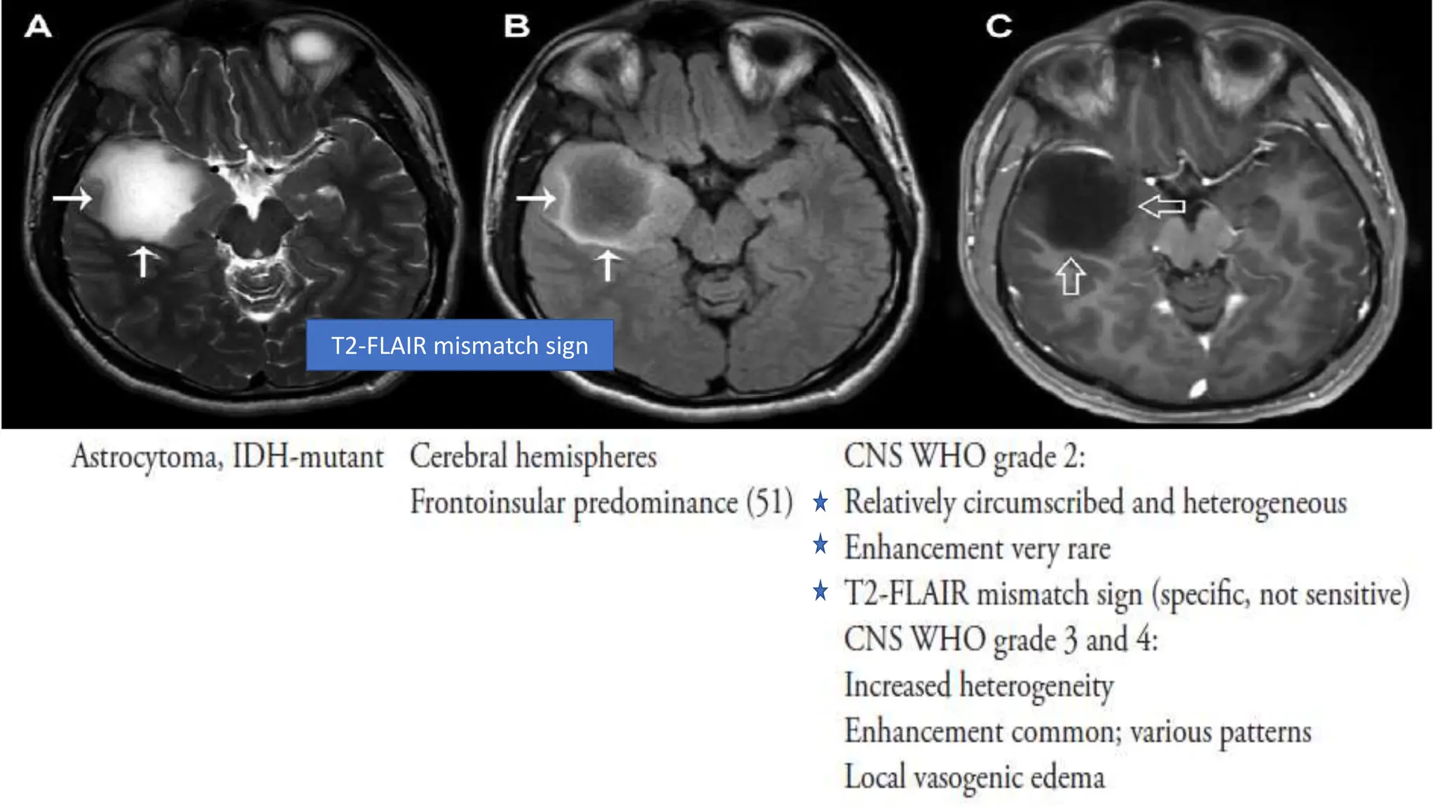 WHO CNS Classification of Tumors 2021-2.pptx