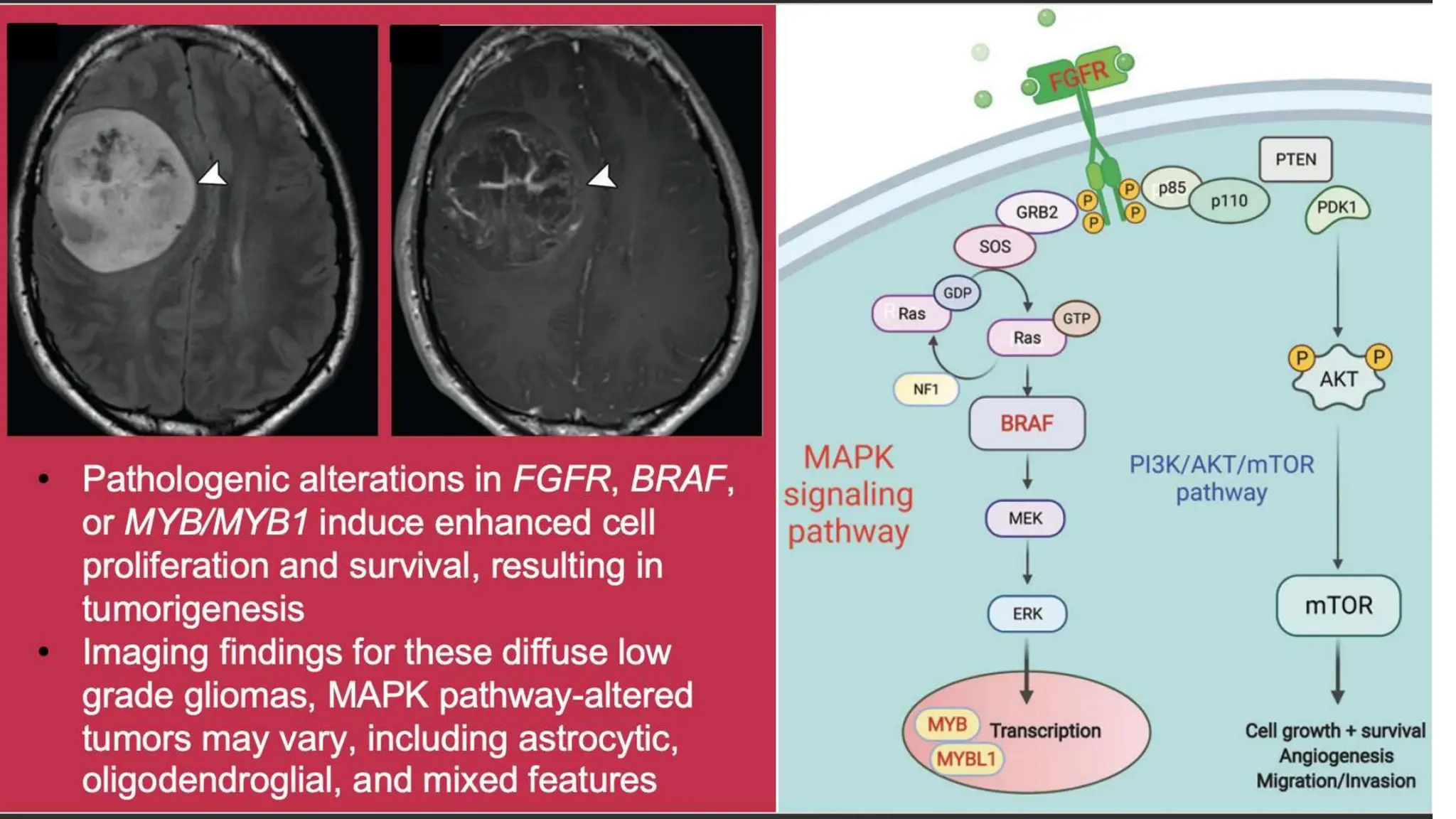 WHO CNS Classification of Tumors 2021-2.pptx