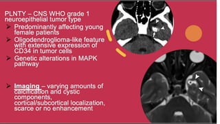 WHO CNS Classification of Tumors 2021-2.pptx