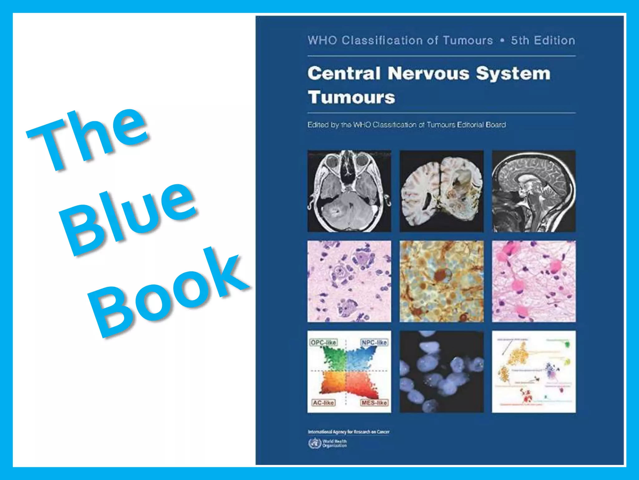 WHO CNS Tumor Classification 2021.pptx