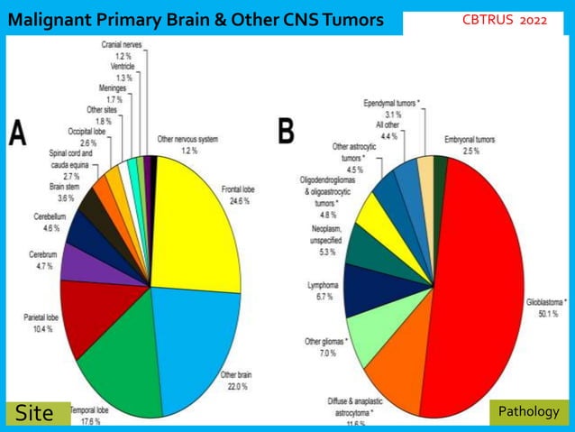 WHO CNS Tumor Classification 2021.pptx | Brain and Nervous System Disorders | Diseases and ...