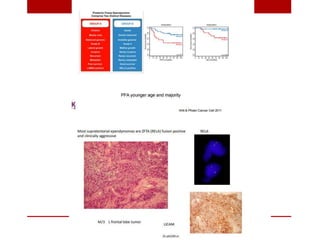 who criteria gbm.ppt