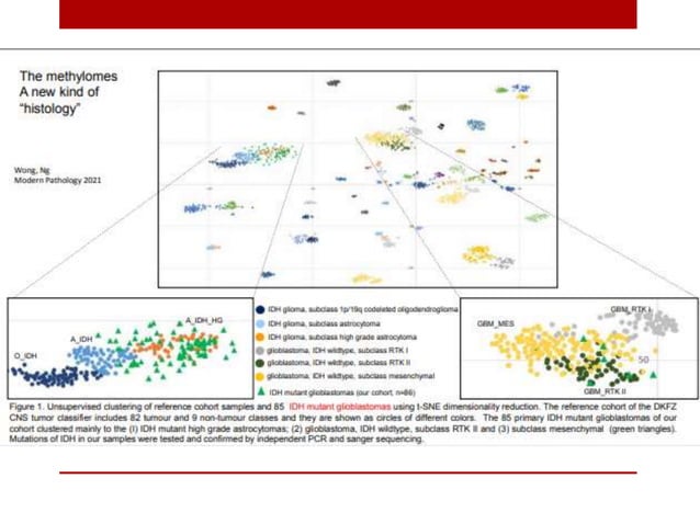 who criteria gbm.ppt