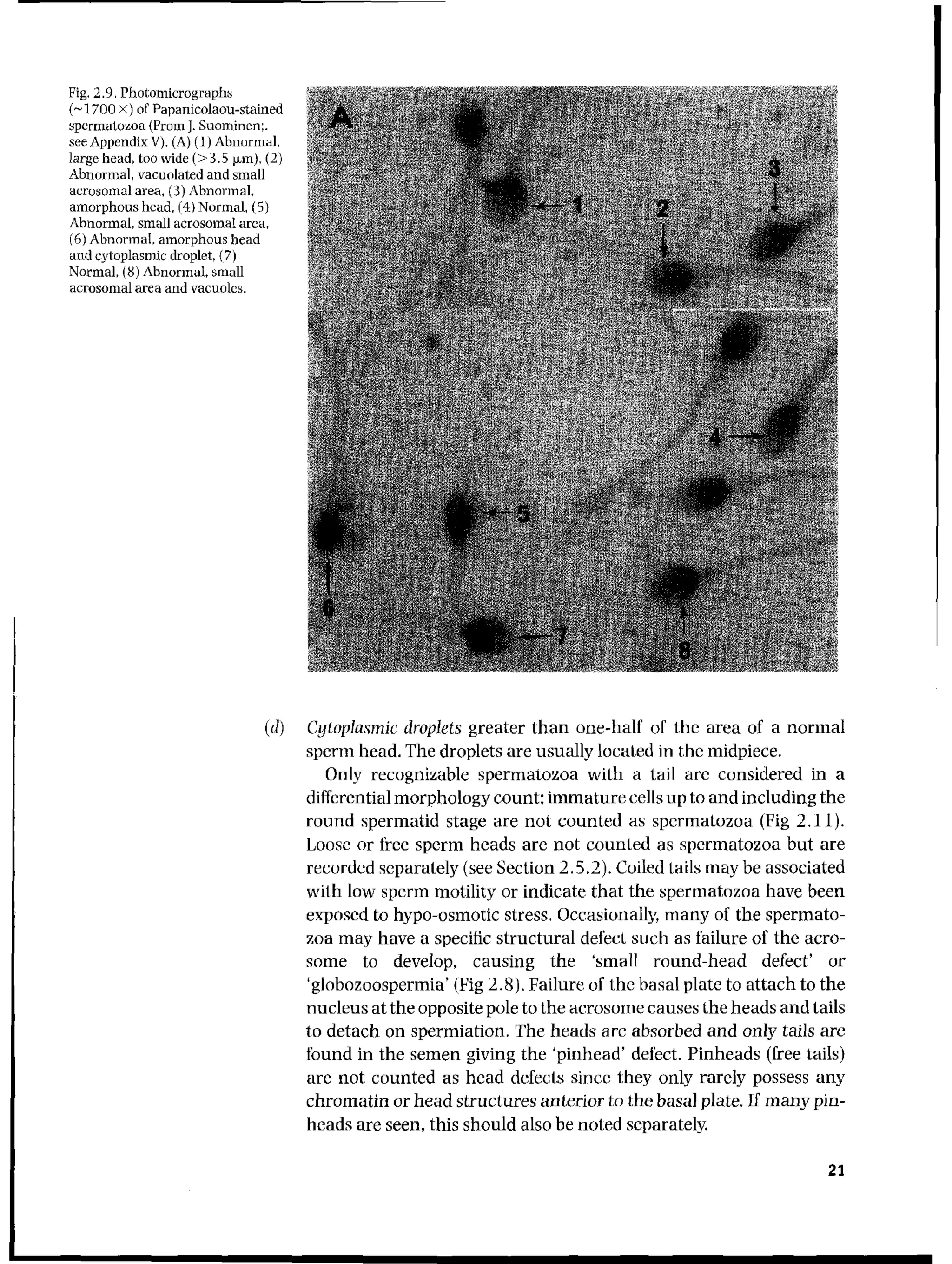 who laboratory manual for the examination of human semen and sperm ...